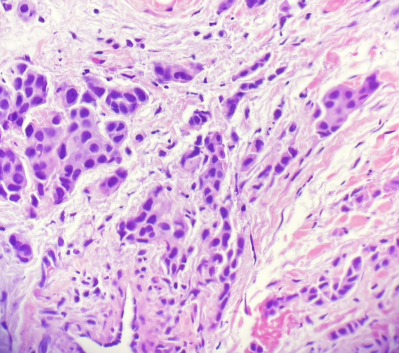 Toward curing cancer: What you must know as a patient about shared ...